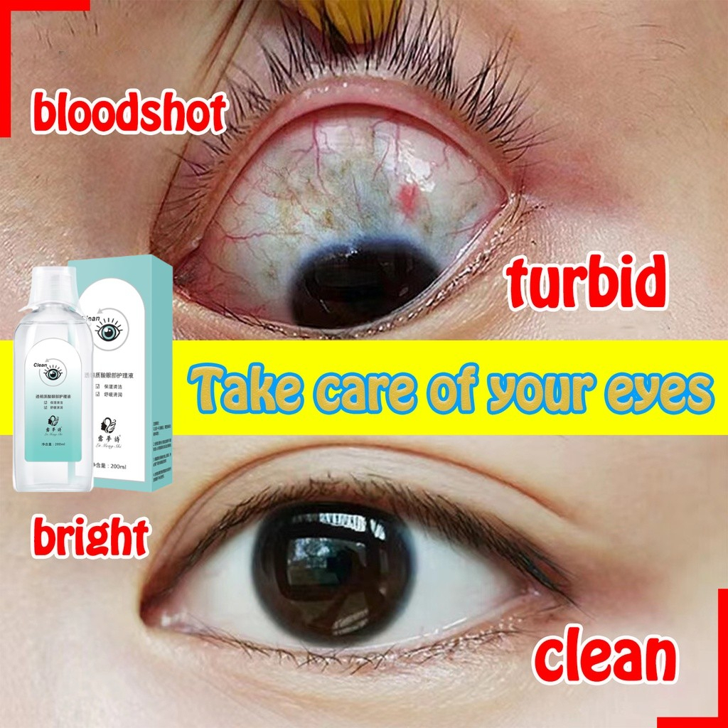 Eye wash, eye care solution, Clean eye care solution, clean eye water ...