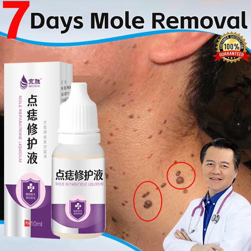 ubat buang tahi lalat hidup skin tag remover wart mole lighten melanin ...