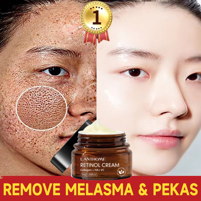 Krim jeragat whitening freckle cream dark spot remover freckles removal ...
