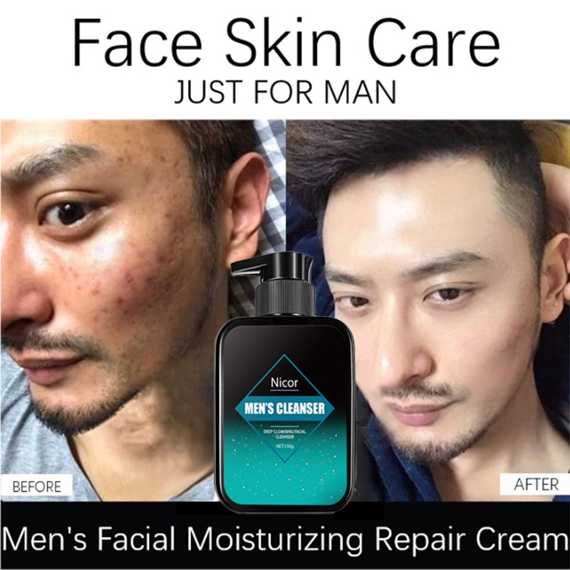 men's facial cleanser mites acne Oil control shrink pores blackhead ...