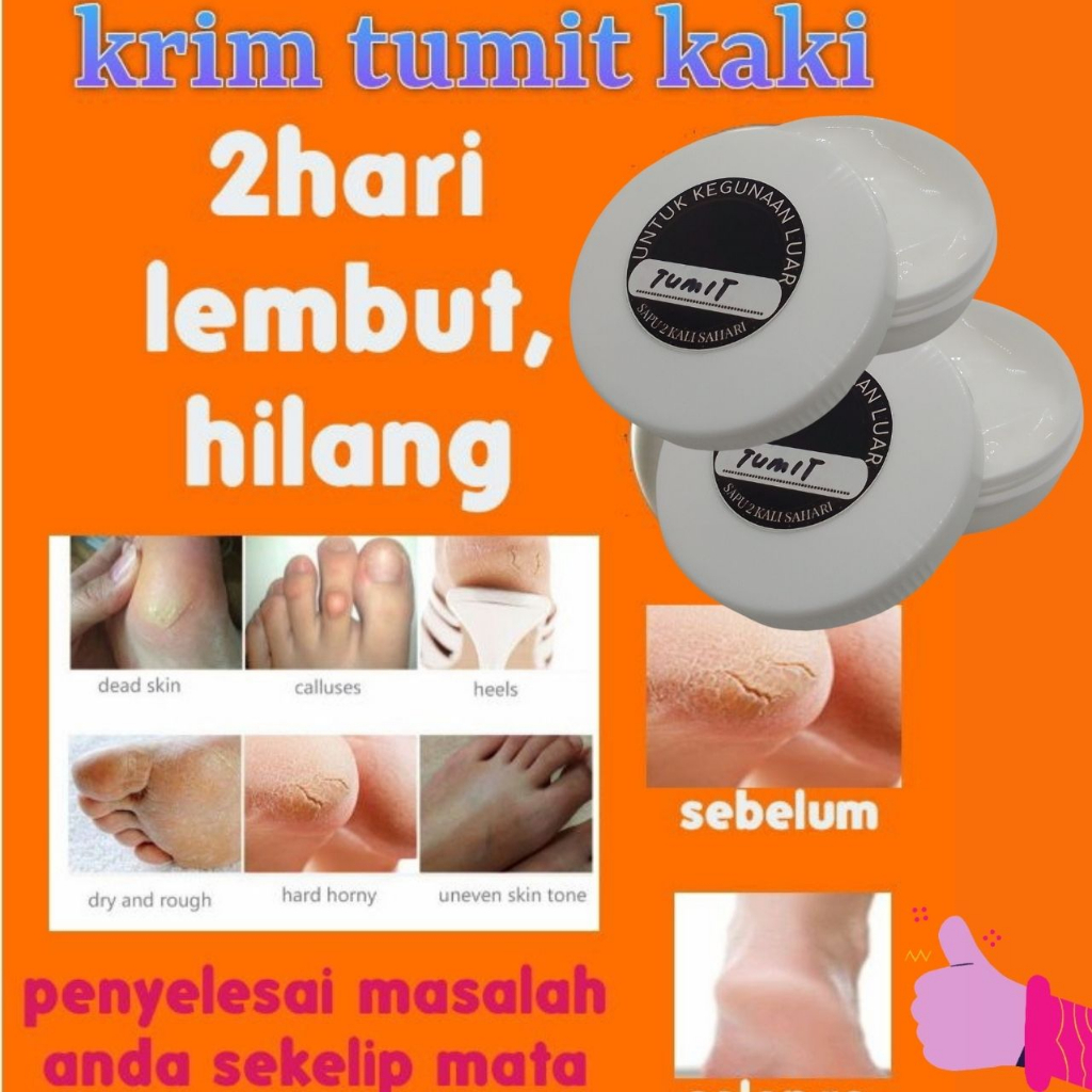 krim tumit kaki,tumit kaki merekah,tumit kaki pecah,tumit kaki keras ...