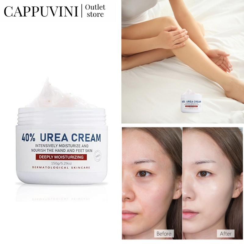 OUKEYA 40% UREA CREAM 150g/ Cream Moisturizes hand skin, rough, dry ...
