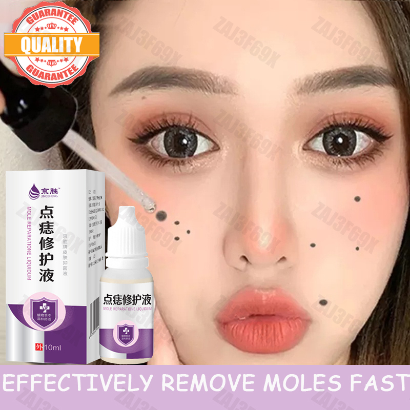 Skin Tag, Mole, Corn & Wart Removal 10ml - Buang Tahi Lalat, Kutil ...