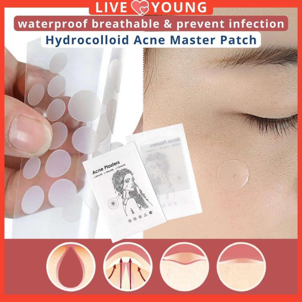 36PCS Acne Pimple Master Patch Blemish Cover Sticker Invisible ...