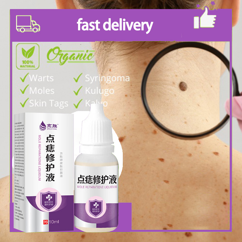 Mole ole Warts Removal wart cream 10ml Wart Drug Removal Medicine Wart ...