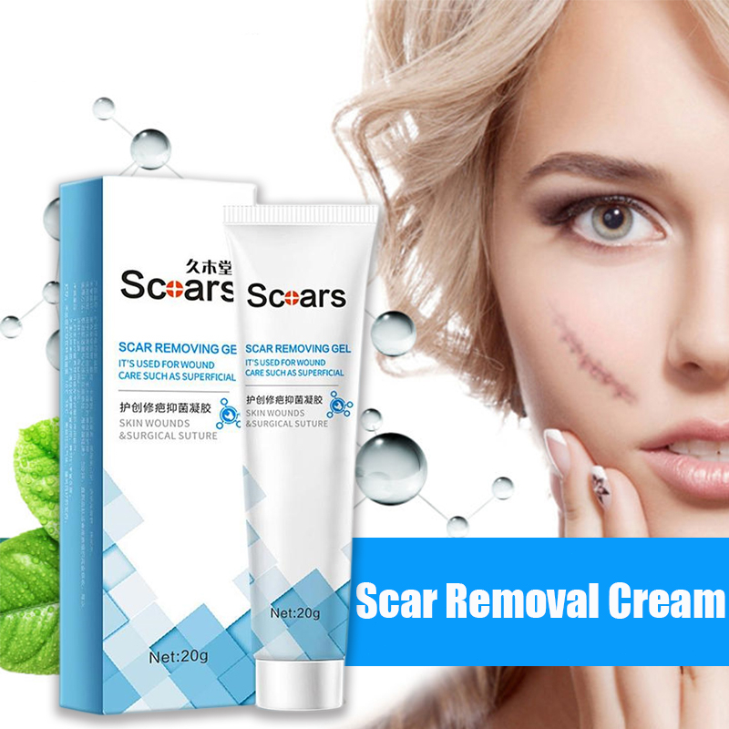 Scar Removal Cream Treatment Remove Stretch Marks Burns Scald Repair ...