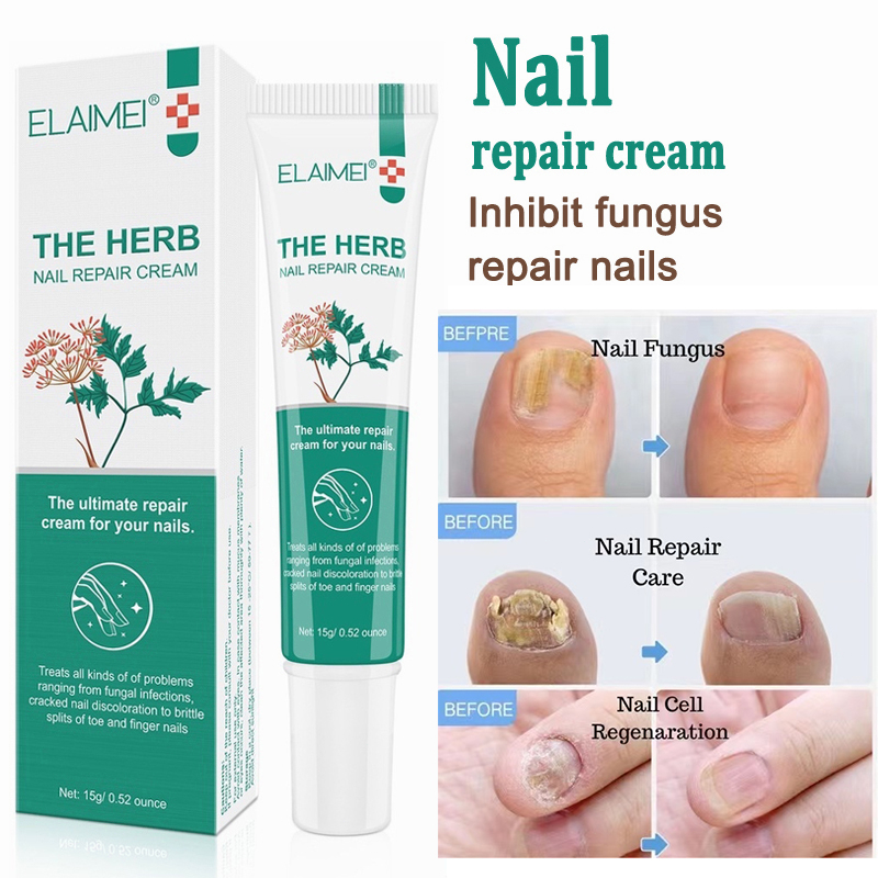 Nail Care Cream Nail Repair Cream Onychomycosis Herbal Ingredients ...