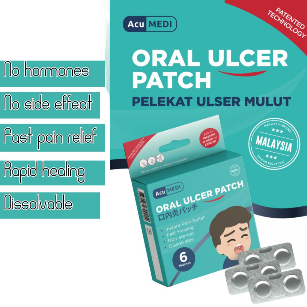 Oral Ulcer Patch Viral AcuMEDI Ready Stock Malaysia, Pelekat ulser ...