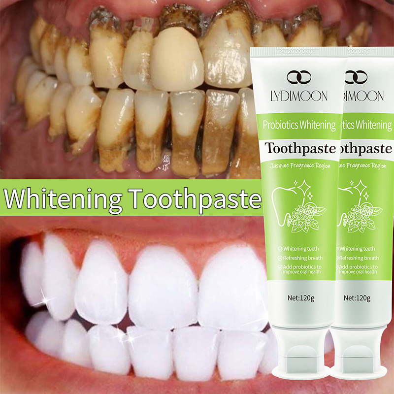 pemutih gigi Probiotic Toothpaste 120g teeth whitening toothpaste ubat ...