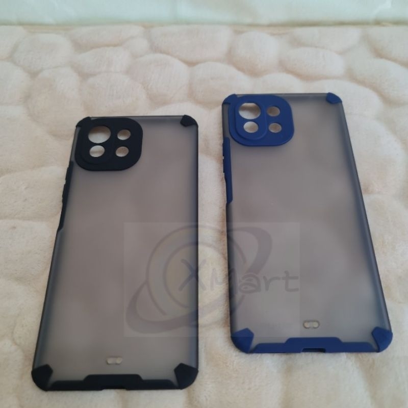 Xiaomi Mi 11 lite 5g Xuan Ying Mosa phone case | Shopee Malaysia