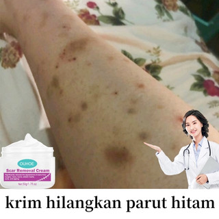 krim hilangkan parut hitam Menghilangkan bekas luka lama Ubat parut ...