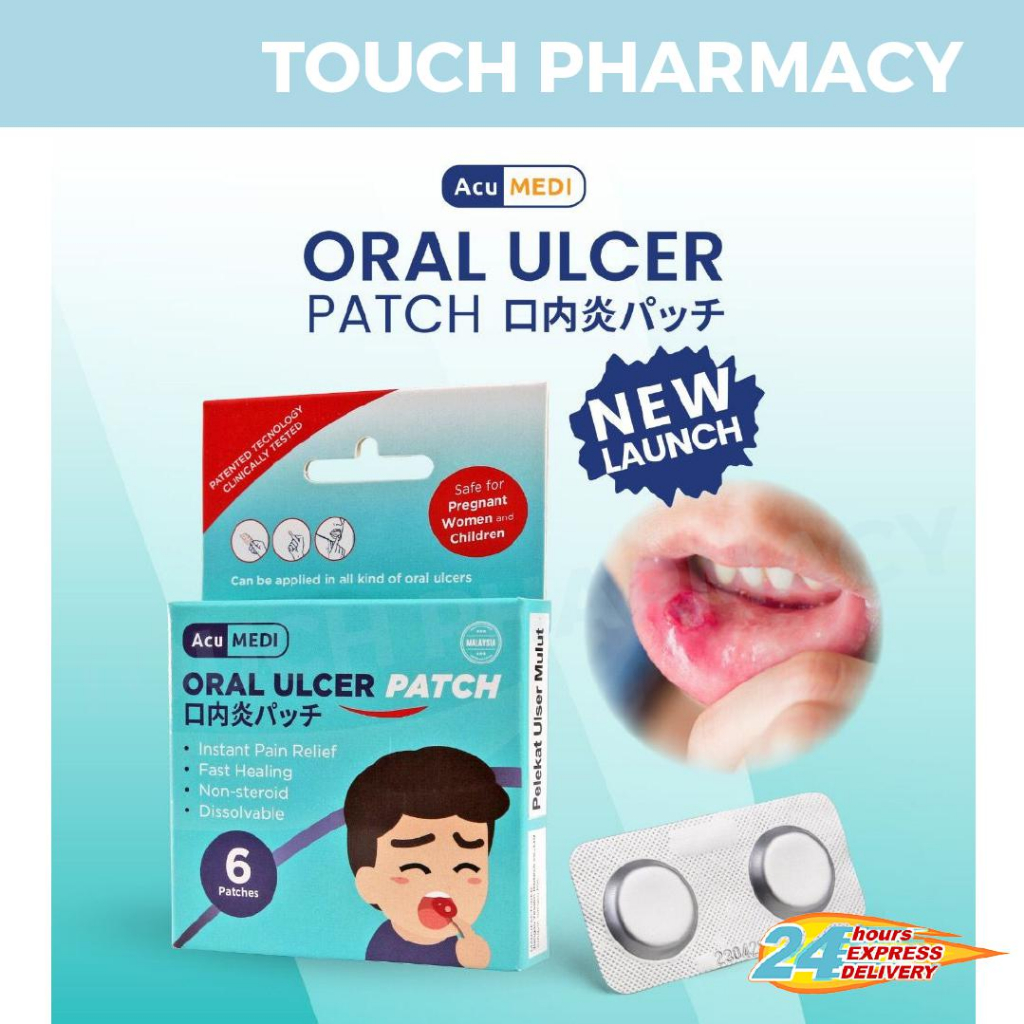 AcuMEDI Oral Ulcer Patch 6's/BOX | Shopee Malaysia