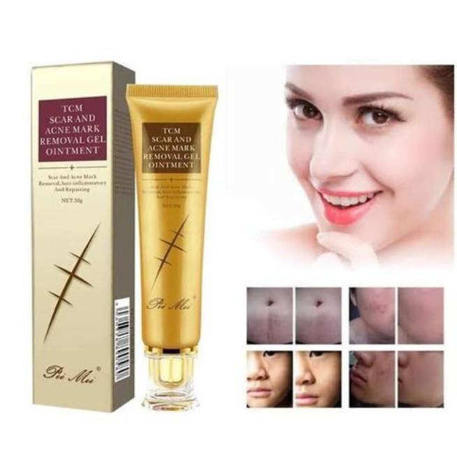 PEI MEI TCM Scar And Acne Mark Removal Gel Ointment 30g | Shopee Malaysia