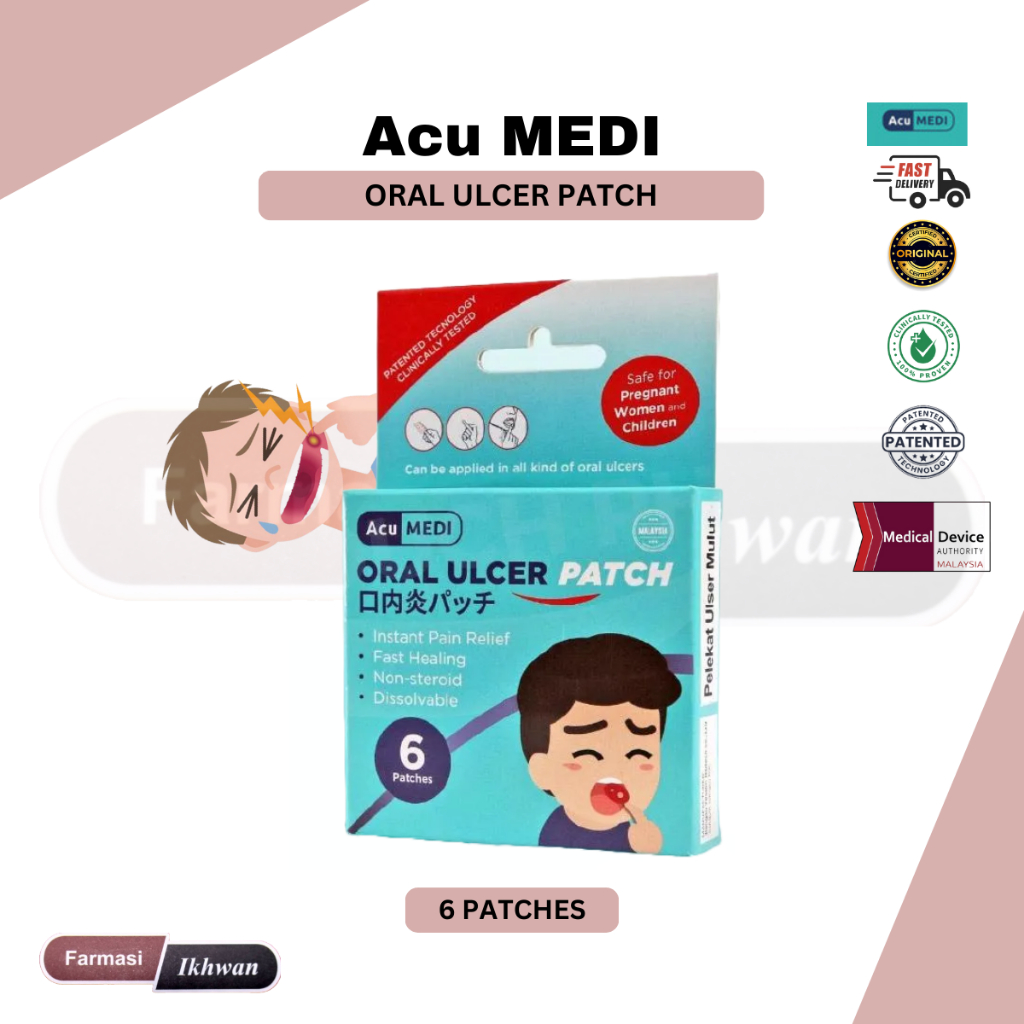 ACU MEDI ORAL ULCER PATCH 6 PCS | Shopee Malaysia