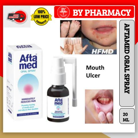 Aftamed Oral Spray 20ML | Shopee Malaysia