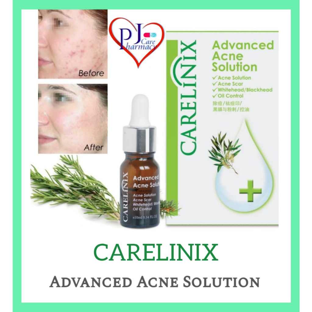 CARELINIX ADVANCED ACNE SOLUTION 10ML [EXP 03/2026] PIMPLES/JERAWAT ...