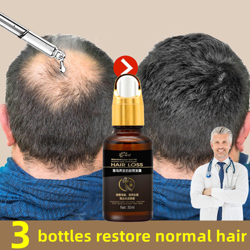 100% efficient Hair Growth Serum Essential Ginger Treatment Hair Loss ...