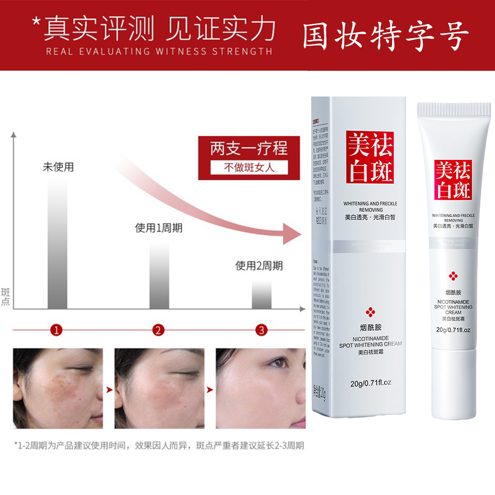 [READY STOCK] Anti Freckle Whitening Cream Whitening and Freckle ...
