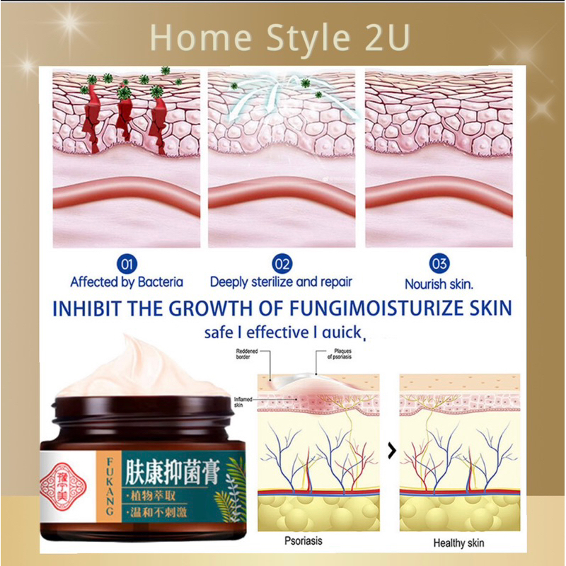 100%Authentic Eczema Cream Antibacterial Cream Psoriasis Cream Ubat ...