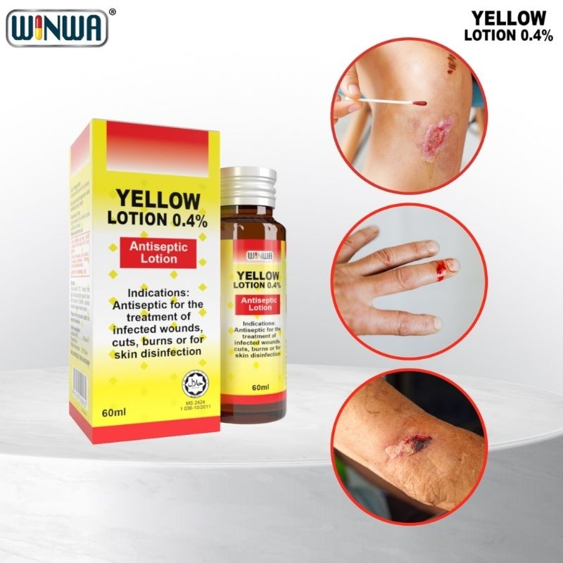 Winwa Yellow Lotion 0.4% Losyen Kuning 黄药水 30ml / 60ml | Shopee Malaysia