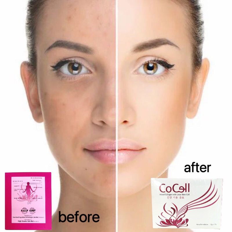 Whitening Booster Premium Collagen Drink CoCell Mixed Collagen with ...