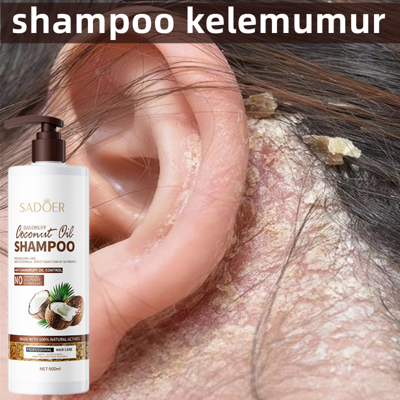 Shampoo Kelemumur Shampoo Dandruff Shampoo Coconut Shampoo Amino Acid Anti-Dandruff Oil Control ...