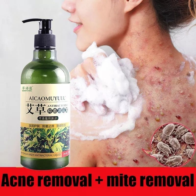 Acne body wash Eczema body wash 艾草沐浴露 500ML Antibacterial Remove Acne/Mite Relieve itching ...