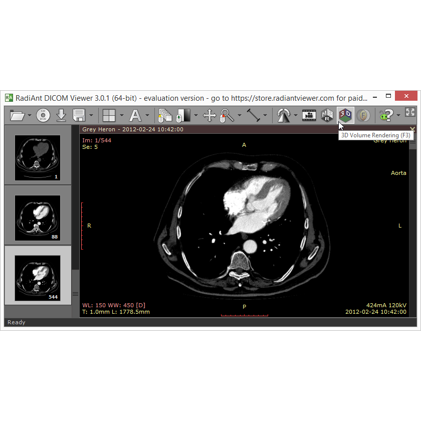 Radiant Dicom Viewer Multiple Windows