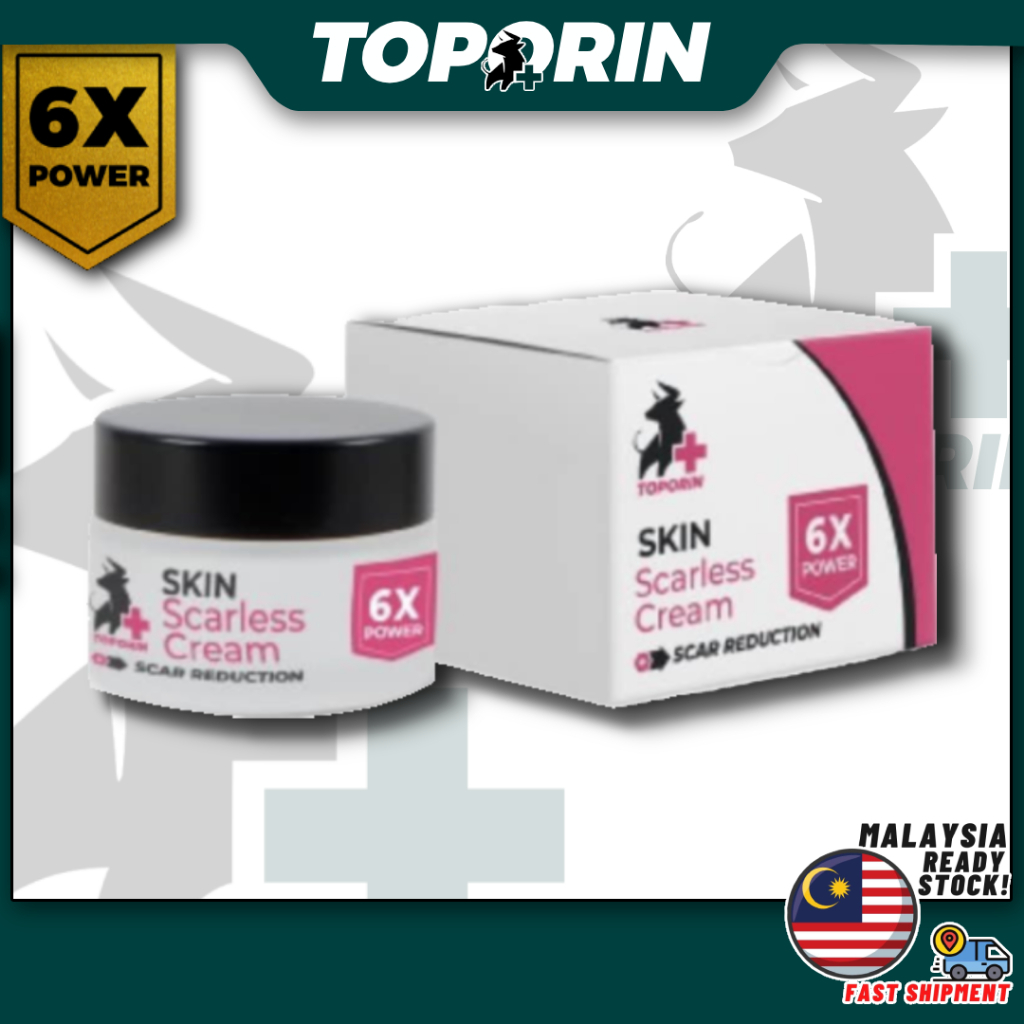TOPORIN SKIN S CREAM 30G | Shopee Malaysia