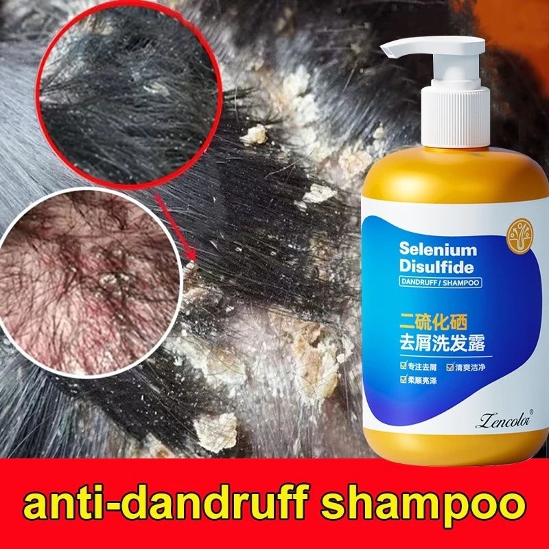 Selenium disulfide anti-dandruff shampoo🇲🇾二硫化硒去屑洗发水 | Shopee Malaysia