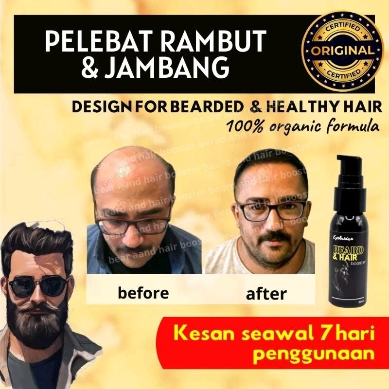 Pelebat rambut melebatkan rambut minyak rambut buah kemiri pelebat ...
