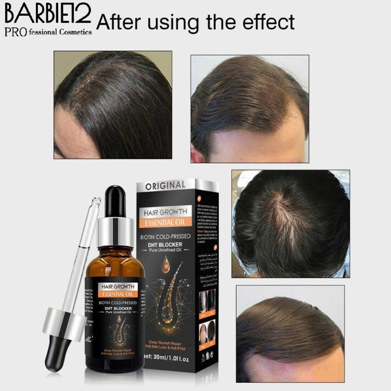 Hair Care Hair Growth Essential Oil Biotin Cold-Pressed DHT Blocker and ...