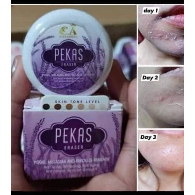 capadosa pekas eraser facial cream | Shopee Malaysia