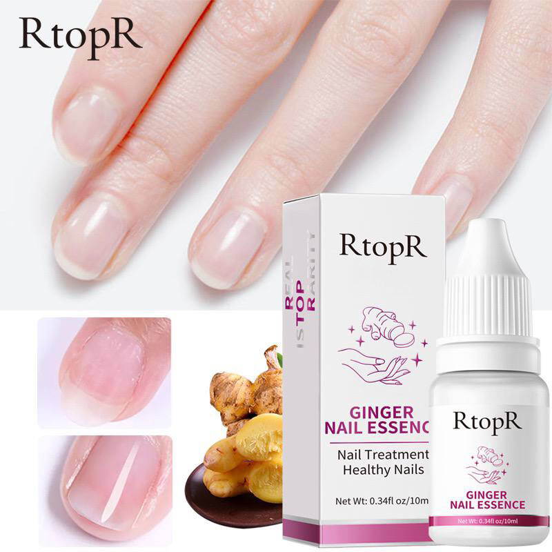 RTOPR GINGER NAIL ESSENCE krim kuku dengan pati halia rawatan kuku ...