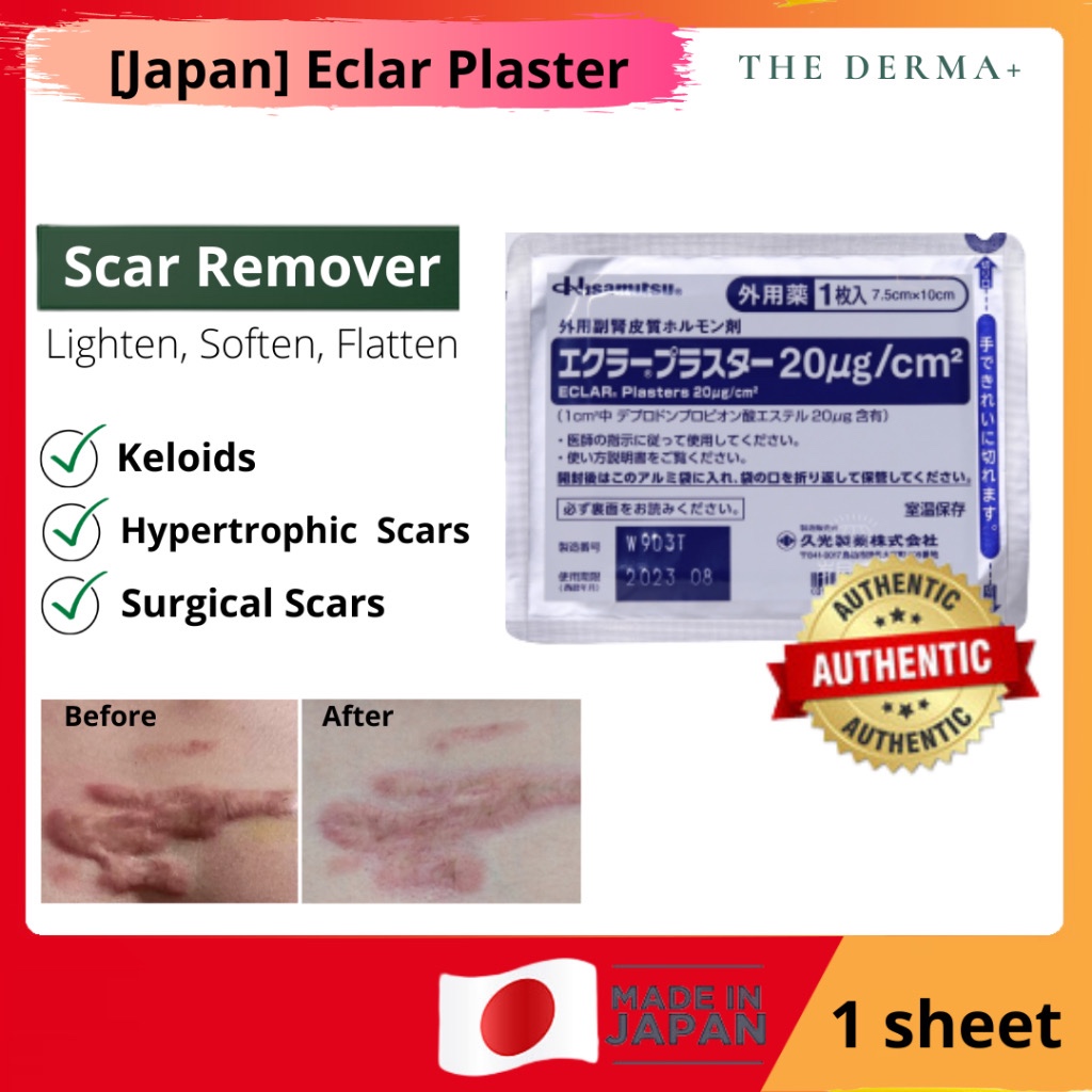 [Japan] Rawatan Parut & Keloid - Hisamitsu Eclar Plaster Scar Removal ...
