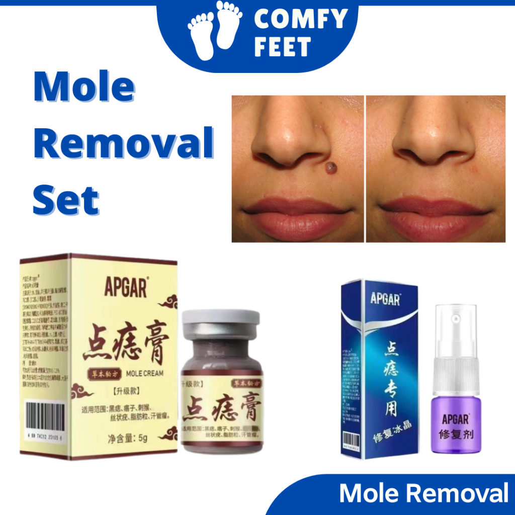 Ubat Kutil Tahi Lalat Ketuat Biji Kolesterol Warts removal cream Skin ...