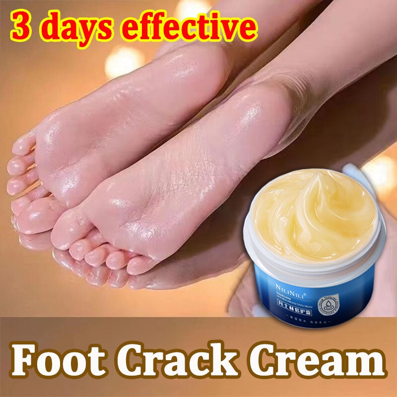 Vaseline Foot Cream Hand Cream Heel Crack Cream 80g Hand Foot Repair ...