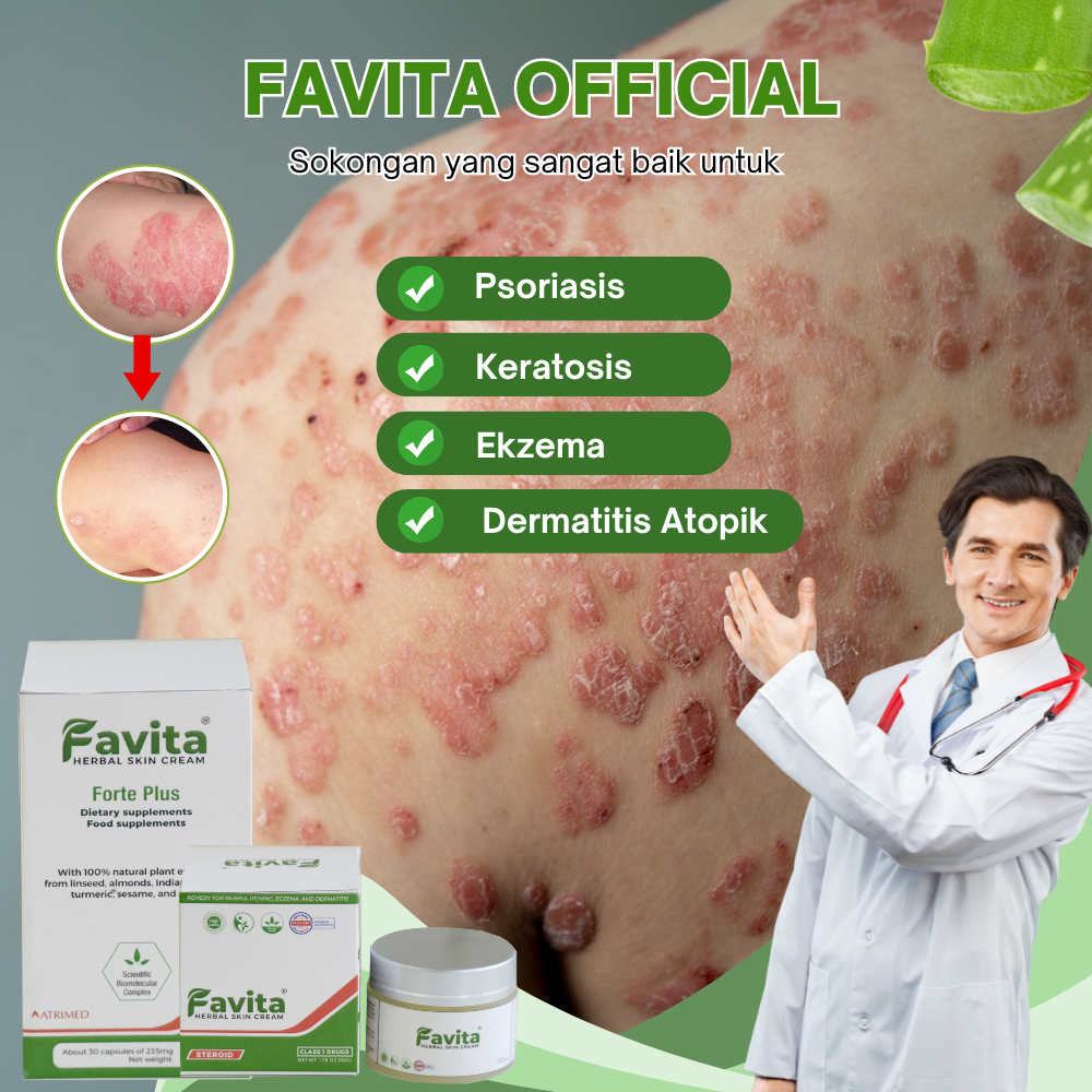 Krim anti-gatal Favita, Merawat psoriasis, ekzema, ruam, dermatitis ...