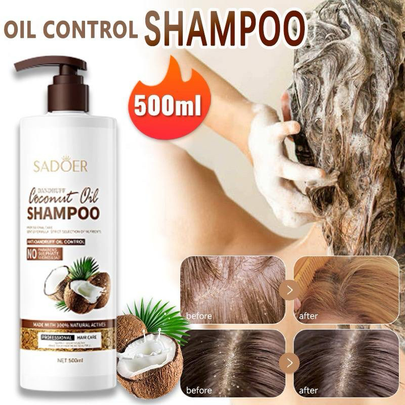 SADOER SHAMPOO ANTI DANDRUFF shampoo anti kelemumur anti kulit kepala gatal hilangkan minyak ...