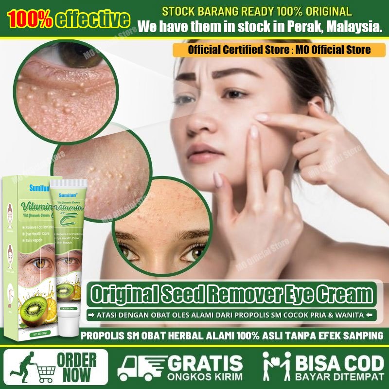 Vitamin E Krim Milia Seed Remover Eye Cream Grease Grains Fat Granule ...