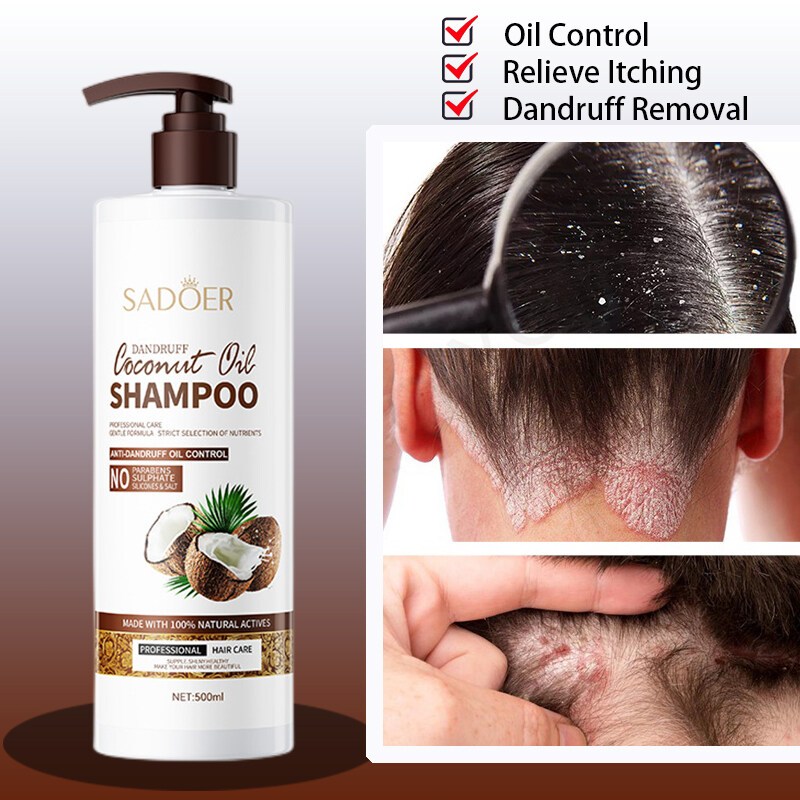 SADOER Nourishing Coconut Oil Dandruff Removal Shampoo kelemumur Rawat rambut kelemumur Kulit ...