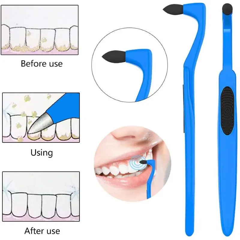 Tooth Stain eraser x 1 Pcs | Shopee Malaysia