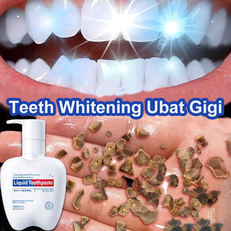 Teeth Whitening Ubat Gigi Whitening Toothpaste 美白牙膏200g Remove calculus ...