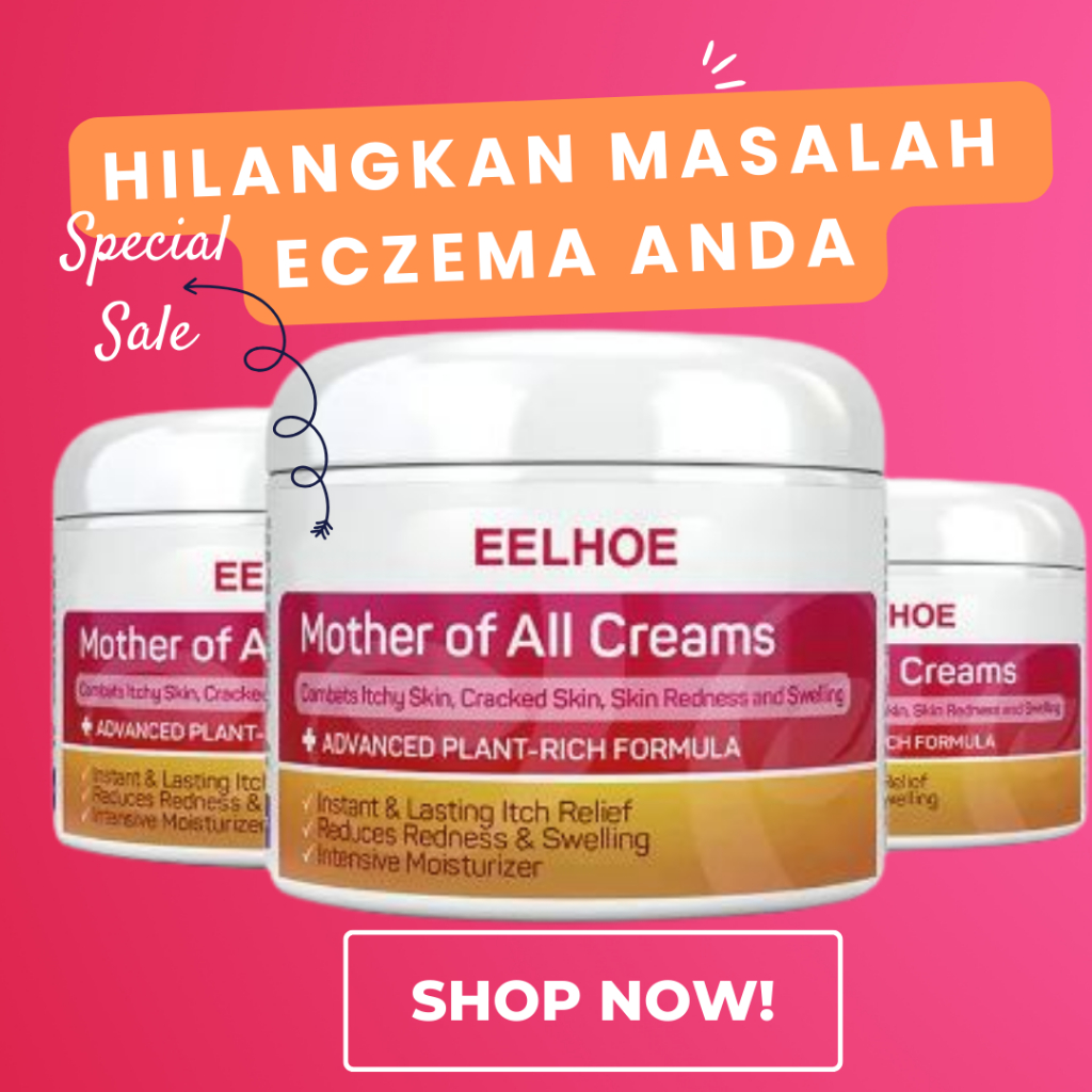Ubat Krim Gatal Kulit Eczema Cream Eelhoe Losyen Skin Treatment ...