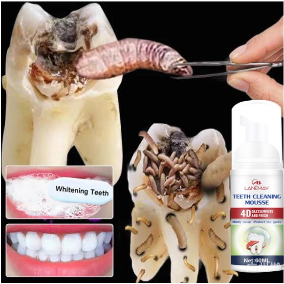 【special offer】 Teeth whitening mousse toothpaste Remove stone tartar ...