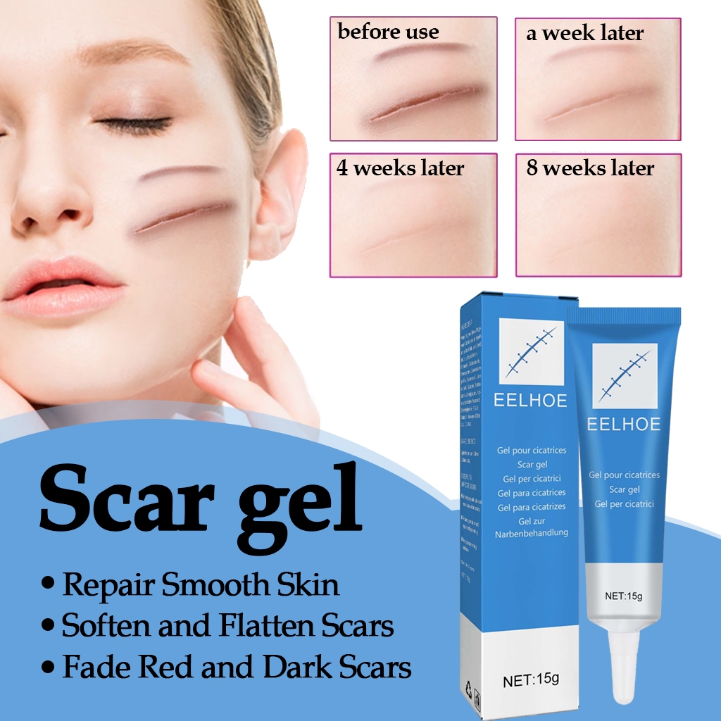Scar Gel Black Scars Remove Leg Scars Remove Old Scars Mosquito Bite ...