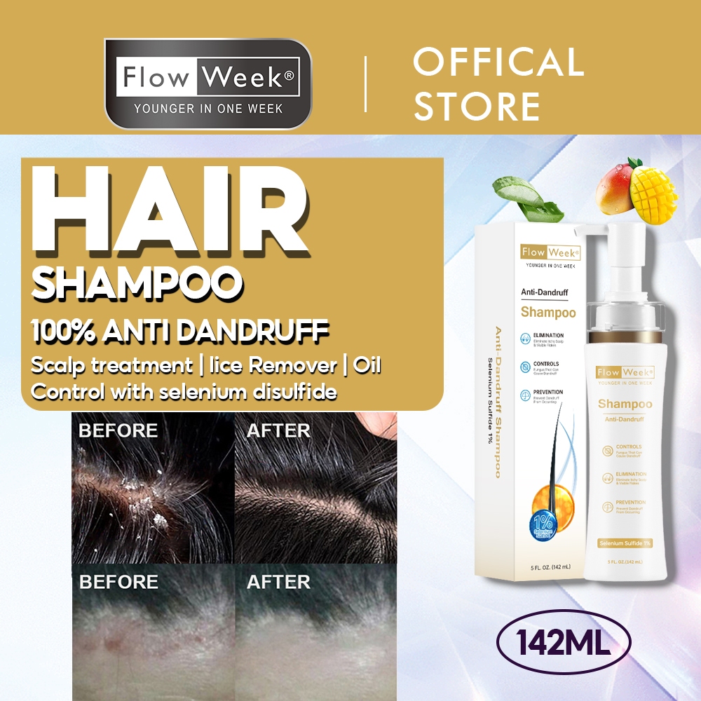 Flowweek Hair Shampoo Anti Dandruff Lice Remover Anti Mite Oil Control Scalp Itching Syampoo ...