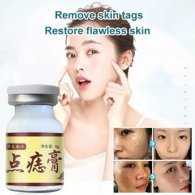 5g APGAR spot mole ointment🇲🇾点痣膏 | Shopee Malaysia