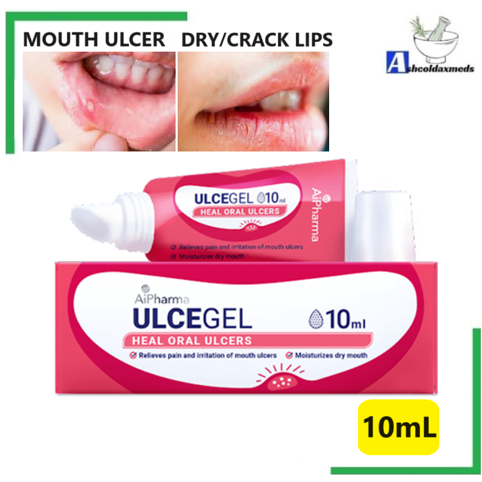 Aipharma Ulcegel for Healing Oral Ulcers and Pain Relief and Crack Lips ...