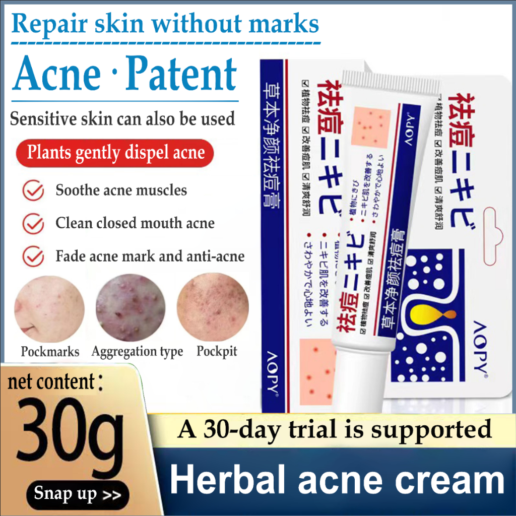 Salicylic acid acne cream krim jerawat 30g Herbal acne cream Soothe ...